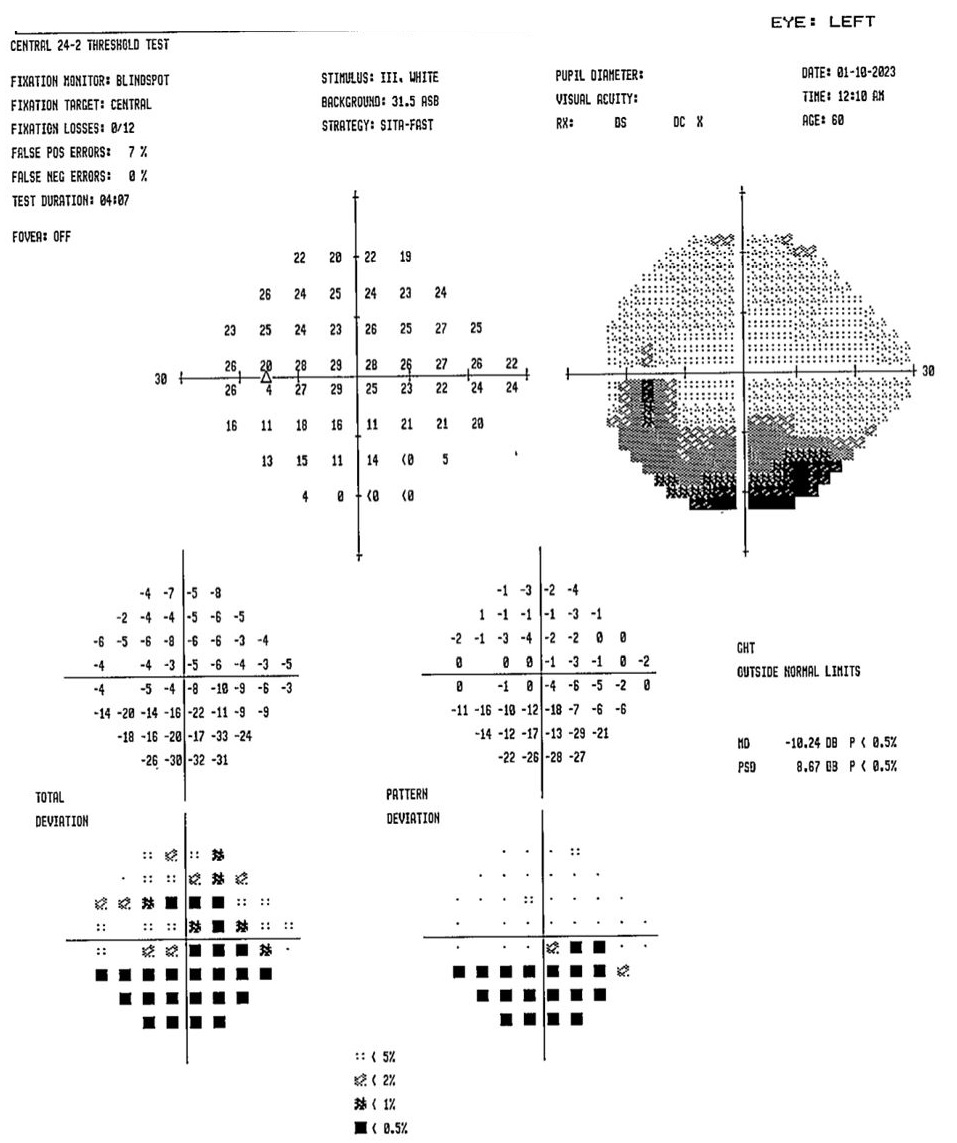 OCT Atlas