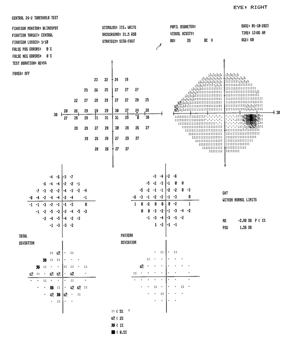 OCT Atlas